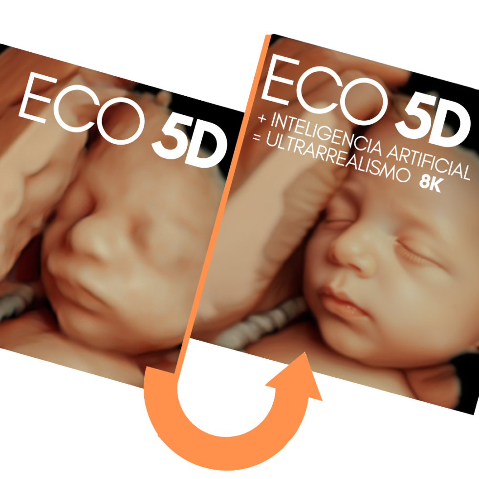 Ecografía 5D con Inteligencia Artificial